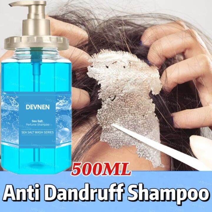 Anti Dandruff Remover shampoo Anti Fungal, Anti Itch Fast results in 15 ...