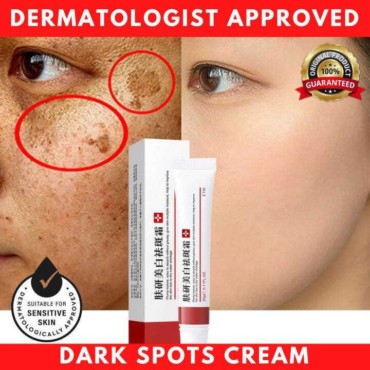 ⭐ ORIGINAL Freckle Cream Pekas Cream Melasma Remover Cream Spot Pigment ...