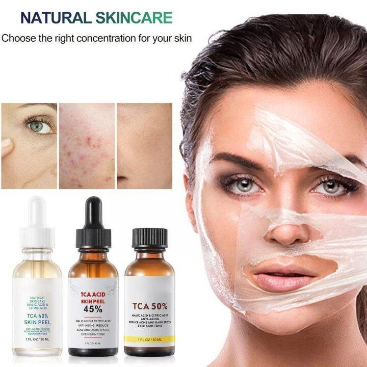 jt2204785jiao TCA 50 Chemical Peel Tca Peel Acid Peeling Acid 7 15 BrightenSkin Days Acne ...
