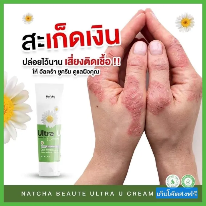 ของแท้ 100% Natcha Ultra U นัชชา อัลตร้ายู ครีม ลดปัญหาผิว (30 g) เก็บโค๊ดส่งฟรี | Lazada.co.th