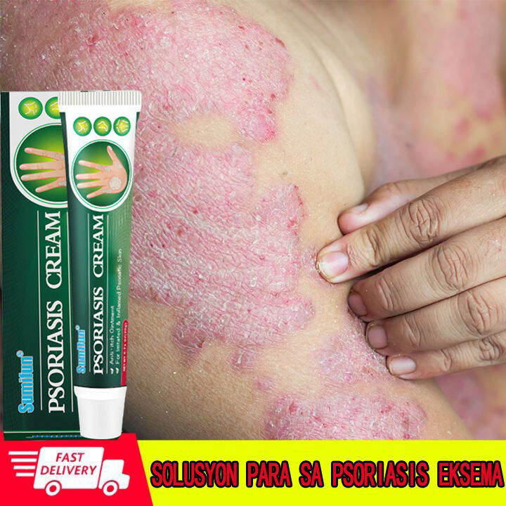 ORIGINAL & Effective Eczema Treatment herbal antibacterial cream 20g ...