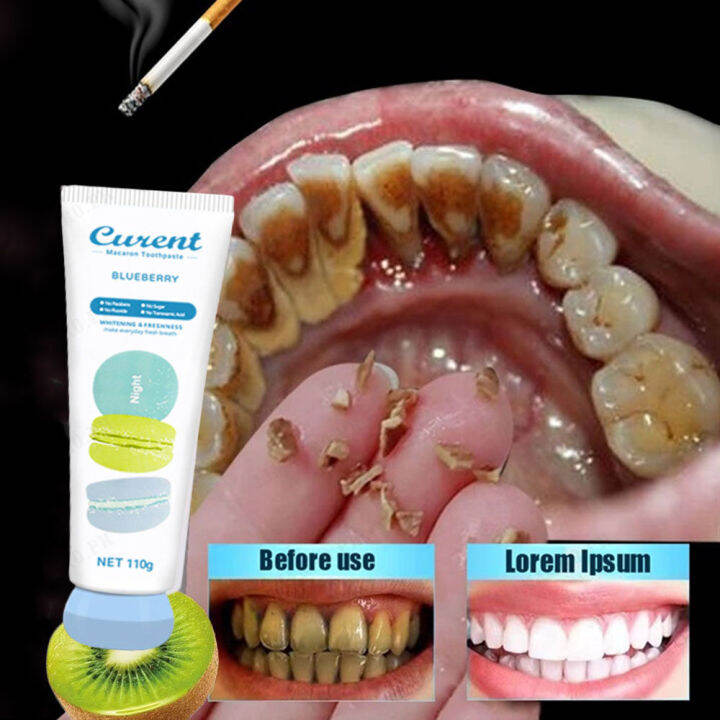 jjmakro Toothpaste cherry blueberry flavor cleans the mouth fresh ...