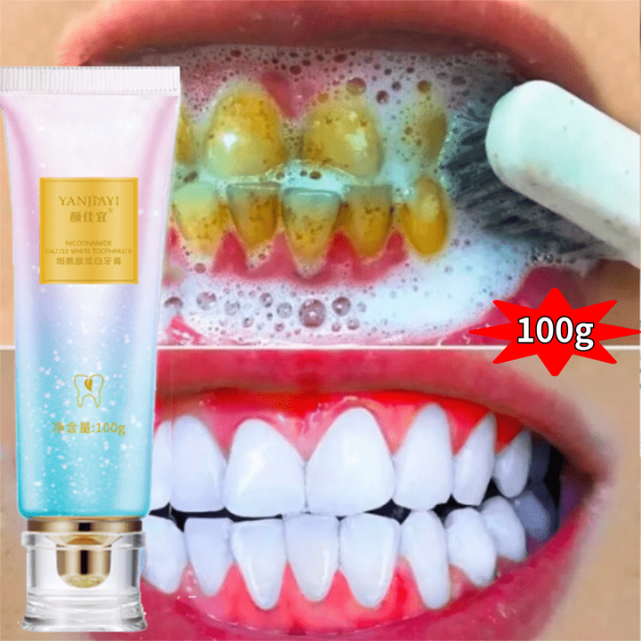 【COD】Niacinamide Whitening Toothpaste teeth whitening stain removal ...