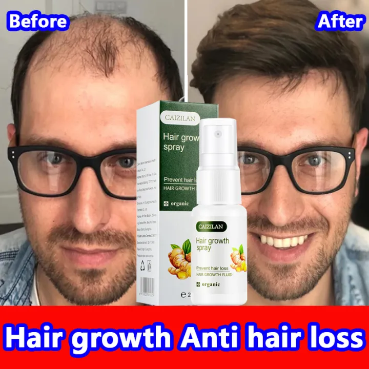 Hair grower for men women original effective hair growth serum spray ...
