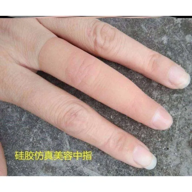 The rubber hand break point set of the index finger thumb gloves for ...