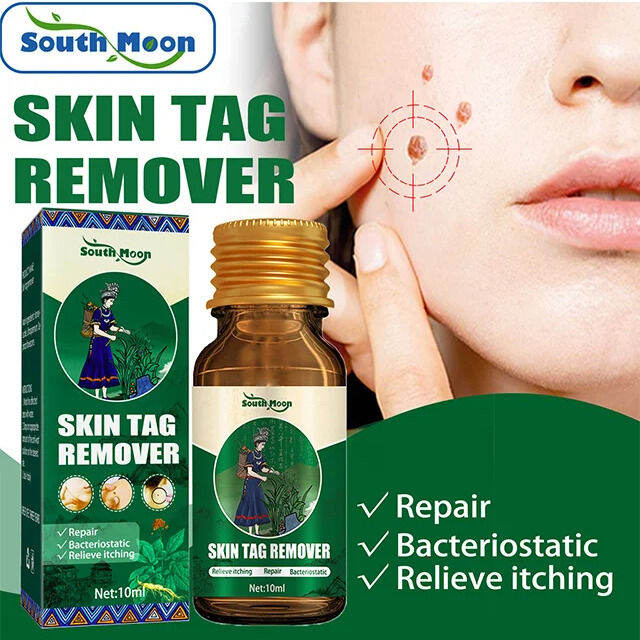 viviqueen Body Wart Remover Skin Tags Removal Liquid Flatness/Corns ...