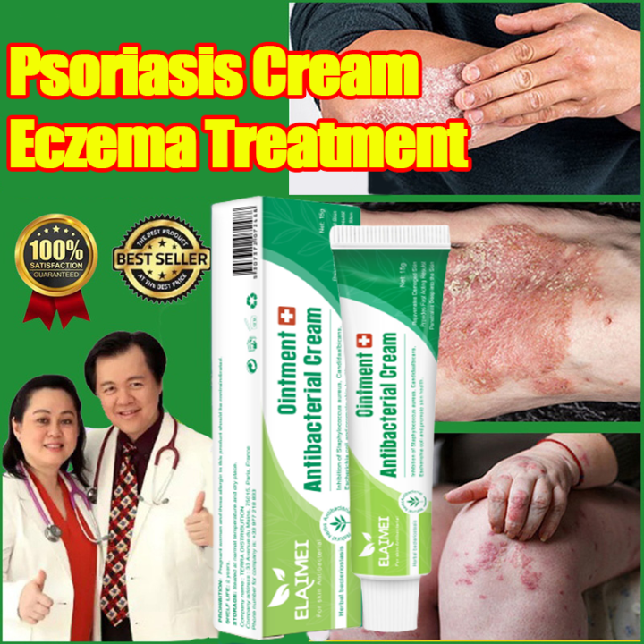 Psoriasis Eczema Cream Antibacterial Anti-itching Herbal Dermatitis ...