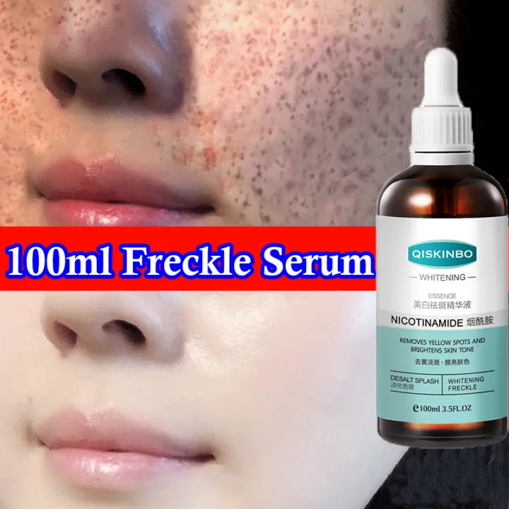Fast Effective freckle removal Serum Whitening Freckle Essence Niacinamide Skin Care Whitening ...