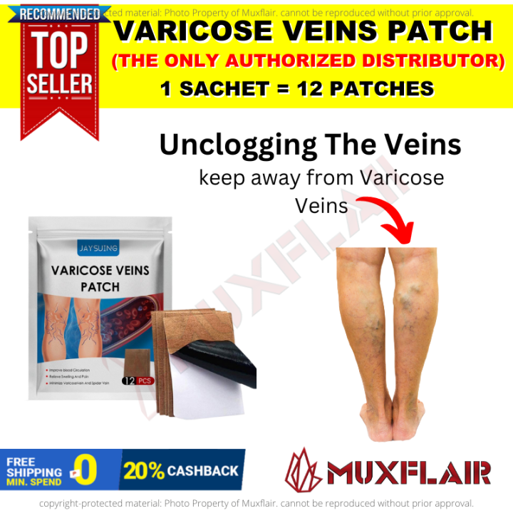 Varicose Veins Patch 12 pcs: Reduce Discomfort and Swelling | Lazada PH