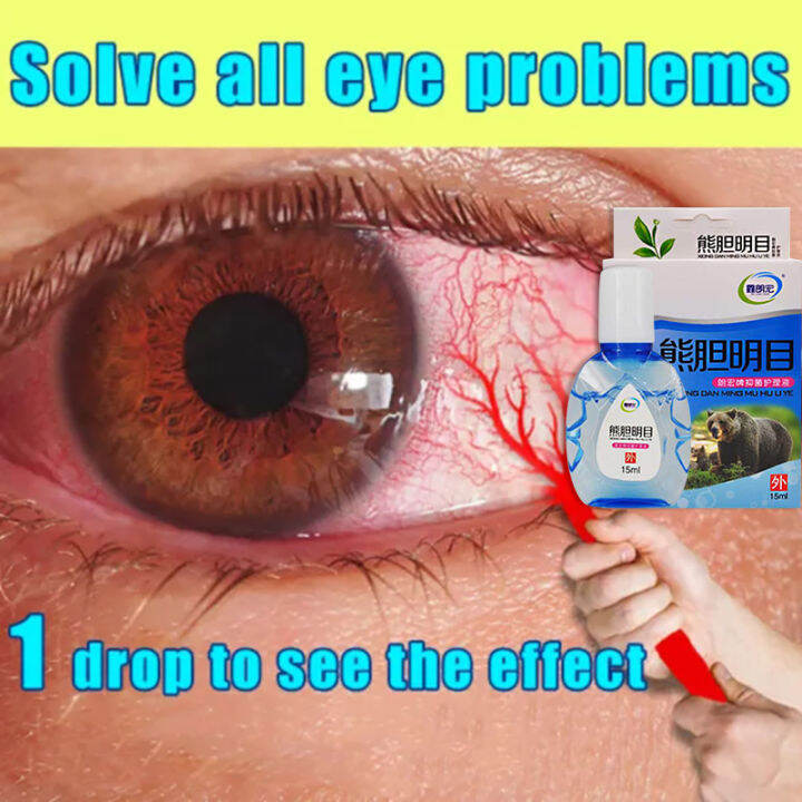 【Restore you vision】Eye Drops Dry Eye Anti-Fatigue Eye Congestion ...