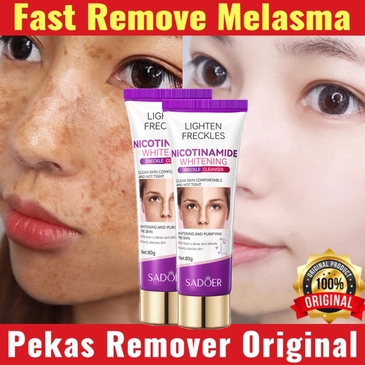 Fast and effective melasma and pekas remover cream original whitening ...