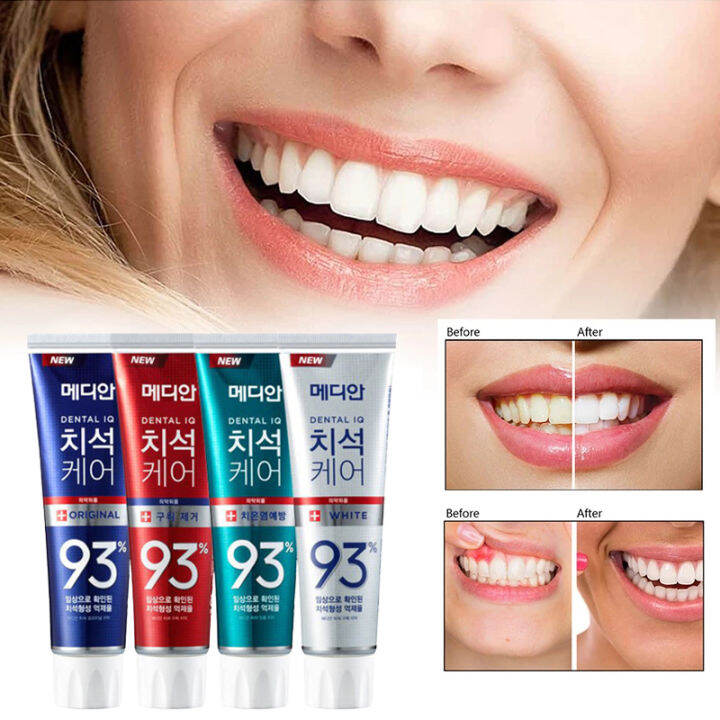 Korean brand 93 Advanced Tartar Dental Iq Toothpaste 120g | Lazada