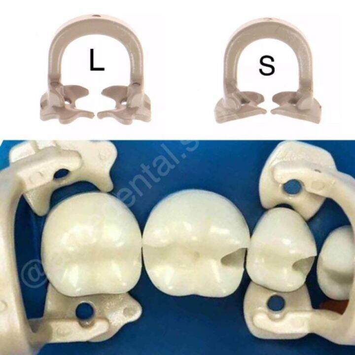 Dental soft clamp rubber dam softclamp rubberdam resin clamps | Lazada ...