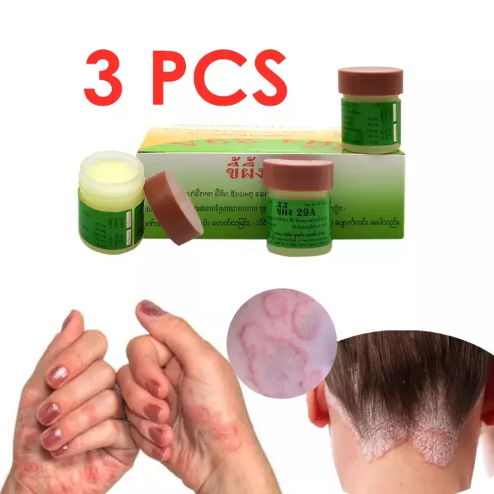 Tattie 3Pcs Thailand 29A Natural Cream for Psoriasi Eczma Chinese ...