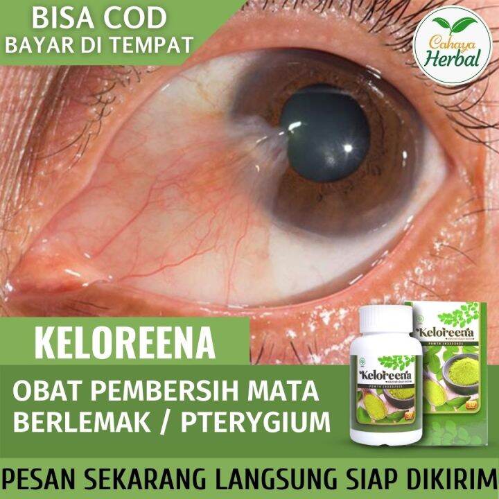 Kapsul Obat Herbal Mata Berlemak, Obat Pembersih Mata Merah Berlemak ...