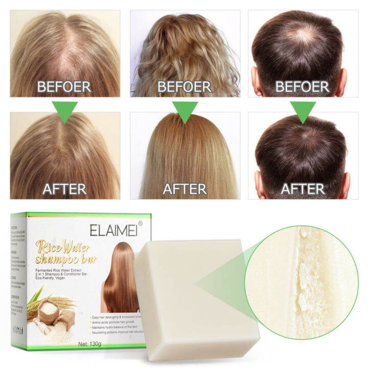 ELAIMEI Rice Shampoo Hair Growth Essence Soap Nourishing Repairing ...