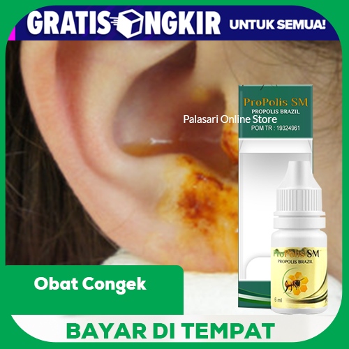 Obat Tetes Telinga Berair Berdenging Infeksi Gatal Bernanah Congek ...