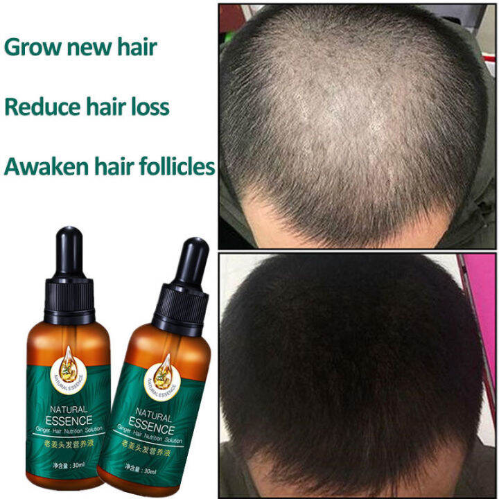 Hair Grower For Men Original Hair Grower Hair Care Products Hair Growth ...