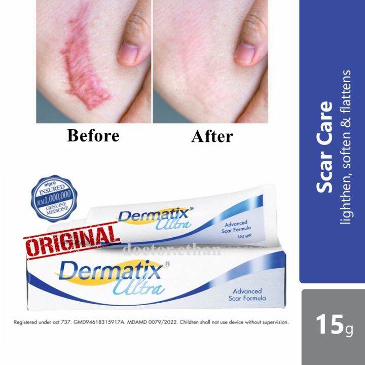 Dermatix Ultra Scar Gel Advance Scar Formula Removal Repair Scar Acne ...