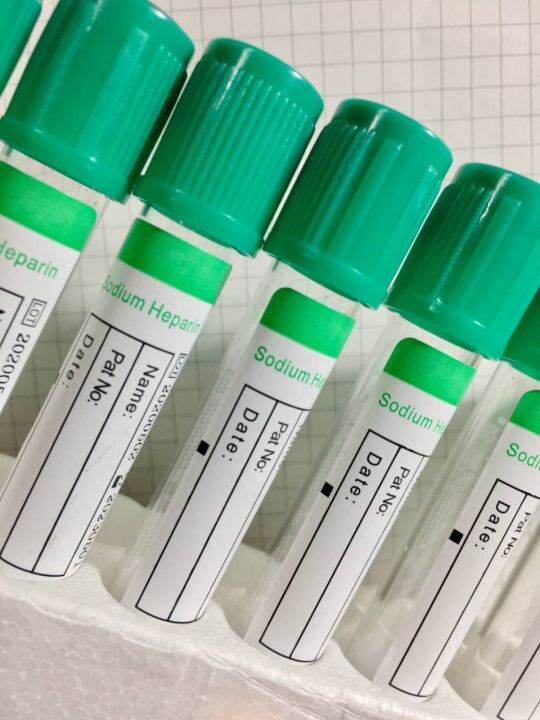 Green Vacutainer with Anticoagulant Additive or Green Vacuum Tube for ...