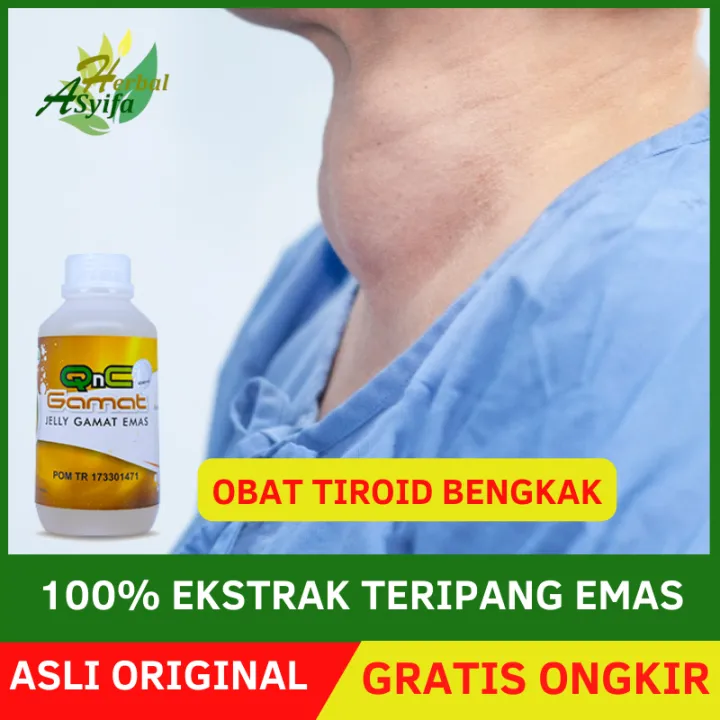 Obat Tiroid Bengkak, Gondok, Kelenjar Tiroid Membesar, Kanker Tiroid ...