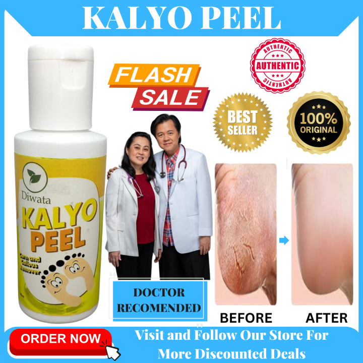 Kutis Diwata KALYO PEEL, Corn and Callous Remover, Softens and ...