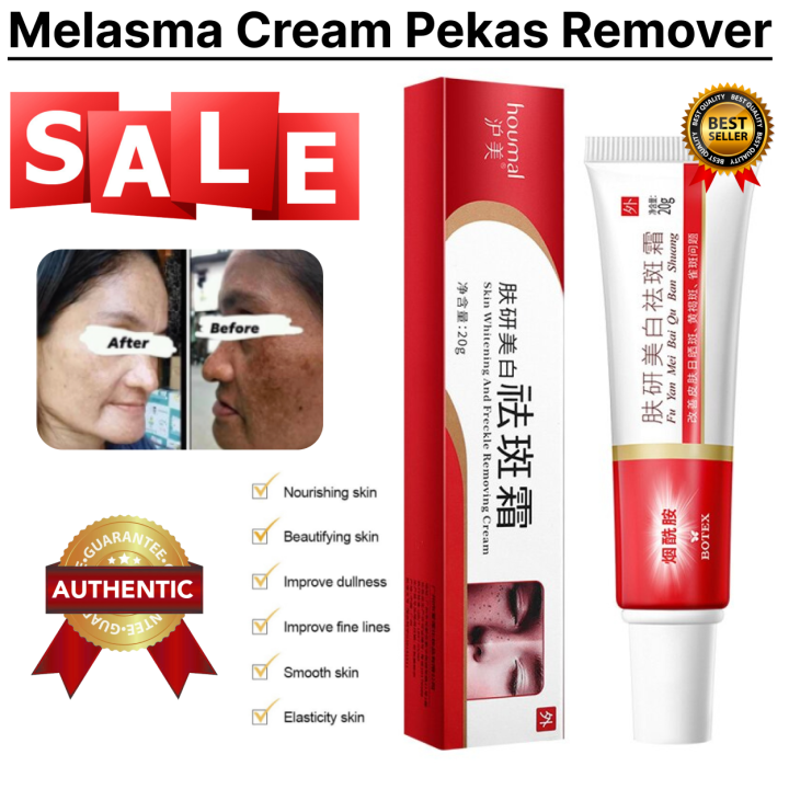 Melasma and Pekas Remover Original Melasma Cream Anti Aging Dark Spots ...