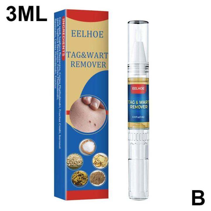 HOLD LIVE Warts Remover Original Kasoy Warts Remover Warts And Skin ...