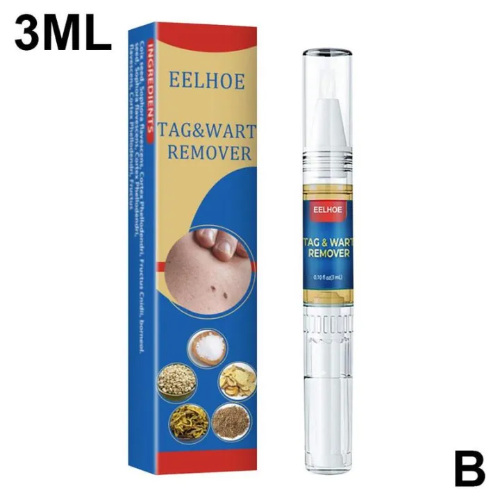 HOLD LIVE Warts Remover Original Kasoy Oil Warts Remover Remover Magic ...