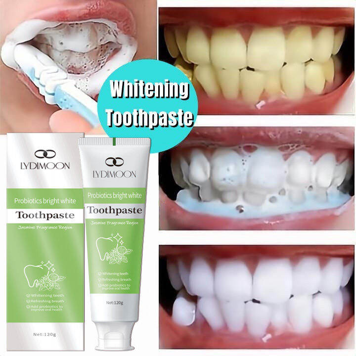 Whitening toothpaste removes tartar, Dental plaque, yellow teeth, smoke ...