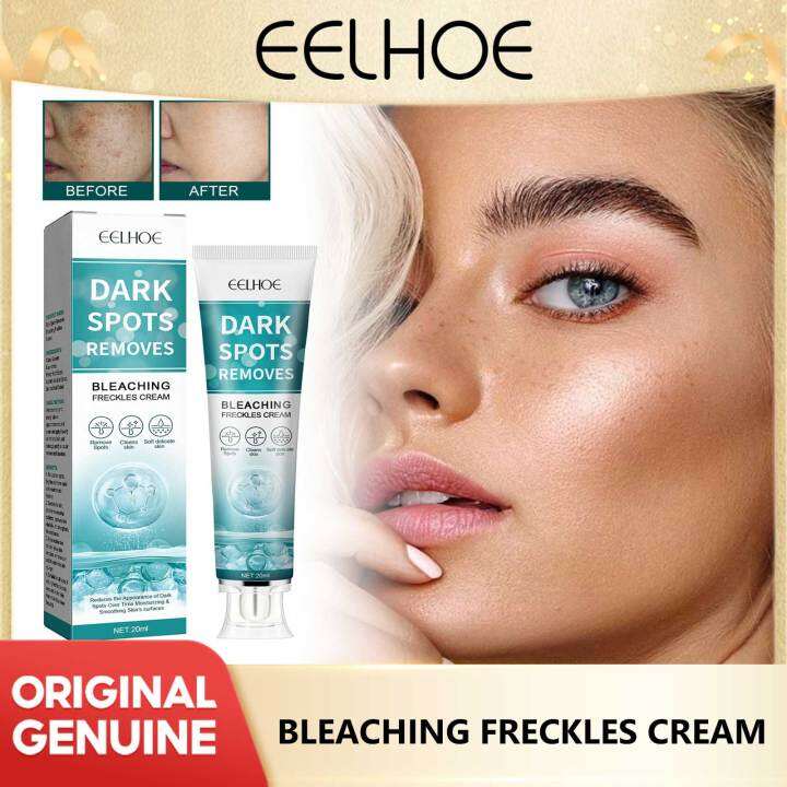Eelhoe Whitening Freckle Cream Dark Spots Removal Improve Dullness