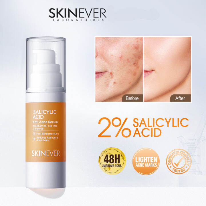SKINEVER Pimple Warrior! Salicylic Acid Acne Drying Lotion - Acne Spot ...