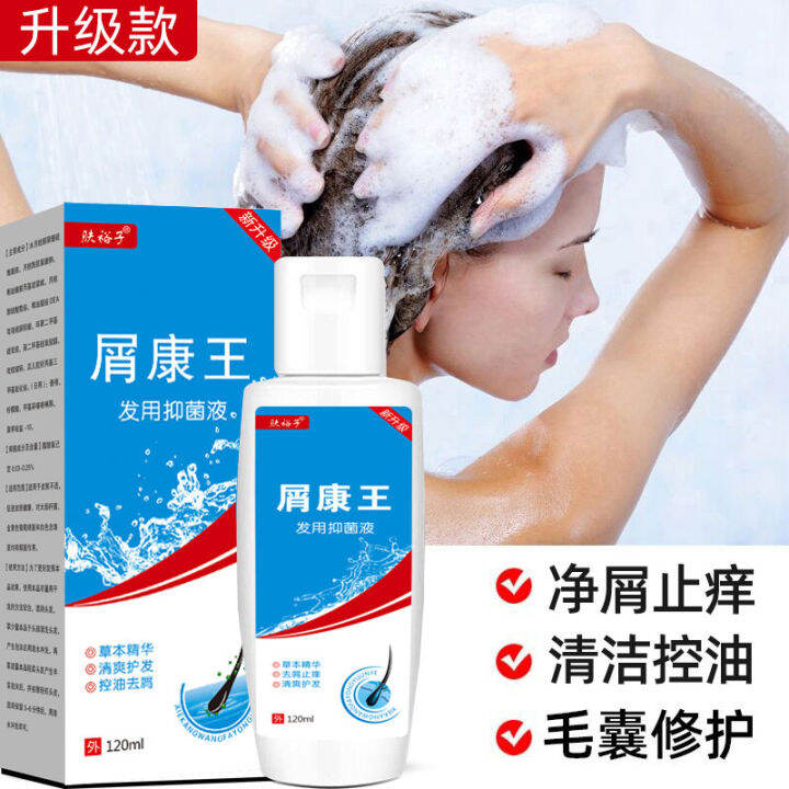 Kang Wang dandruff-removing and itching-relieving shampoo Oil ... Kang Wang dandruff-removing and itching-relieving shampoo Oil ...