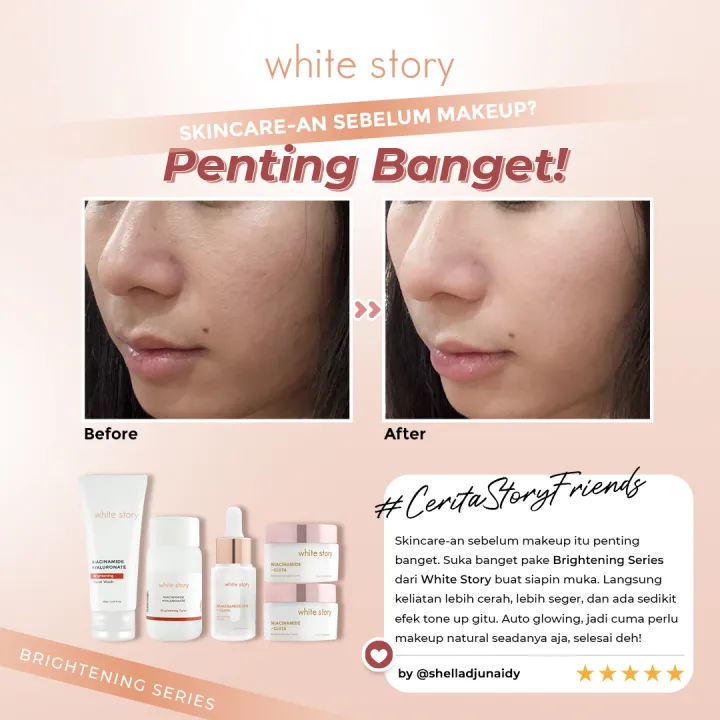White Story skincare Brightening Series membuat kulit wajah yang kusam ...