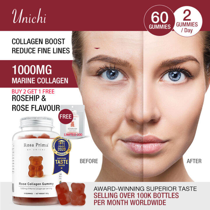 Unichi Rose Hydrolysed Marine Collagen Gummy Rosehip Flavour Whiten ...