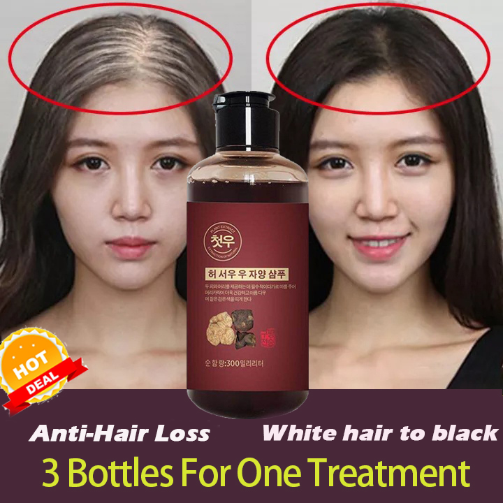 Polygonum multiflorum shampoo, shampoo 300ML Shampoo, white hair ...