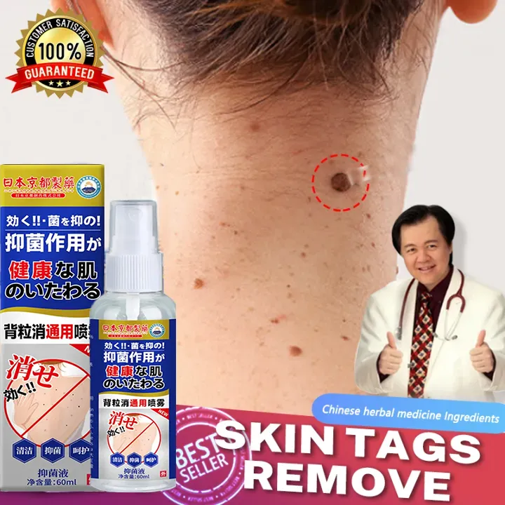 Skin Tag Remover Warts Remover For Body Acne Treatment Spray Mole ...