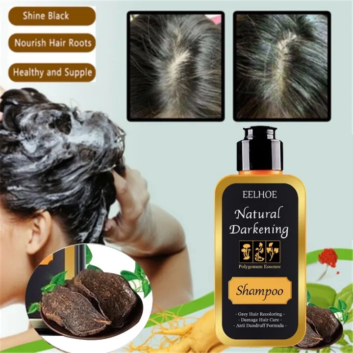 Hair Grower Shampoo Ginger Anti-Dandruff Shampoo Hair Growth Treatments Anti Hair Loss Hair Care ...