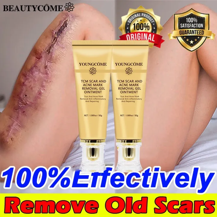 100 Effective Scar Remover For Old Scar On Leg Scar Gel Fixscar Peklat
