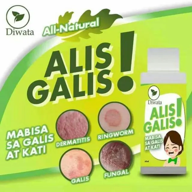 (Chacheers ph) -Diwata Alis Galis Best solution removing Fungi at kati ...