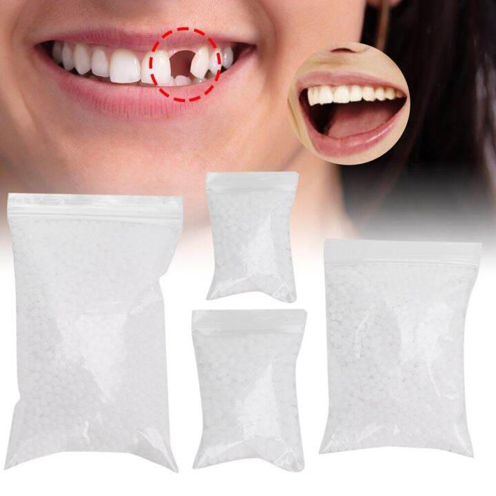 1 Bag Special Plastic Temporary Tooth Bead Denture Repair Teeth Filling ...