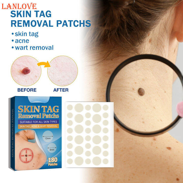 LANLOVE Wart Skin Tags Remover Patches Safe Ingredient Fast Effect Tags Remover Suitable for ...