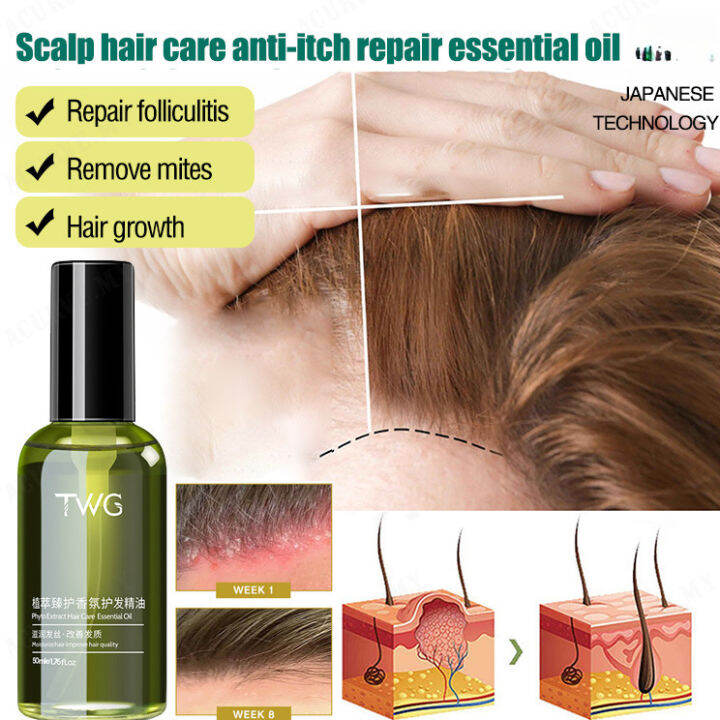 Super-Life Pangangalaga sa buhok para sa buhok ng kababaihan ang ...