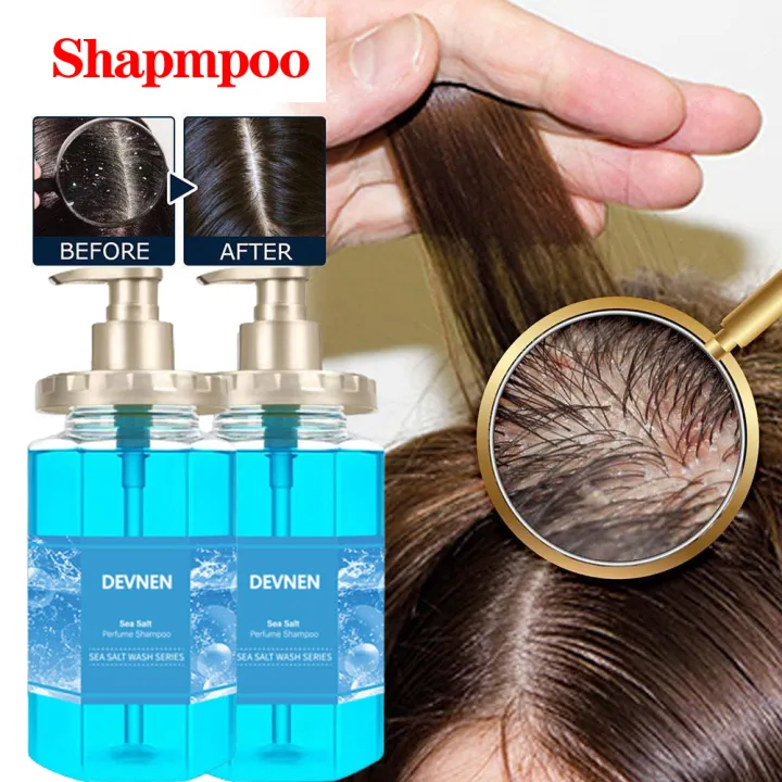 500ML anti sea salt scalp treatment vacuum para sa Fast results in 15 ...