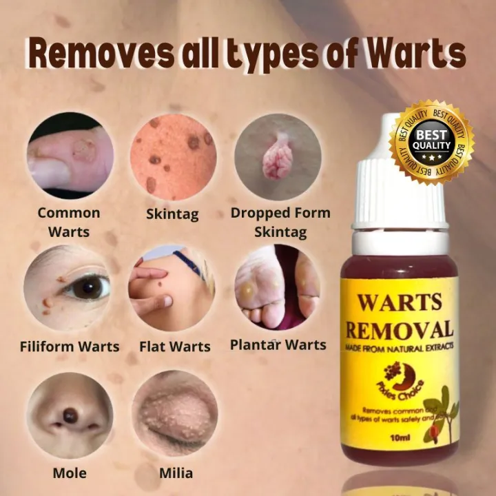 MPH Best Selling 10ml Pure Organic Non-surgical Warts Removal | Mole ...