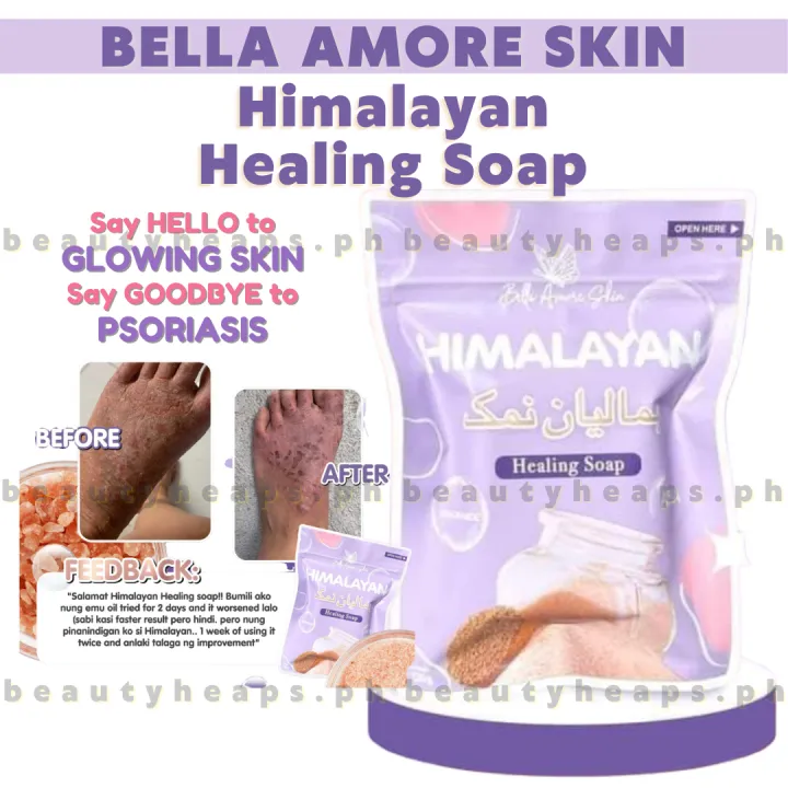 Himalayan Healing Soap Miracle Soap Healing Glass Skin | GlutaBerry ...