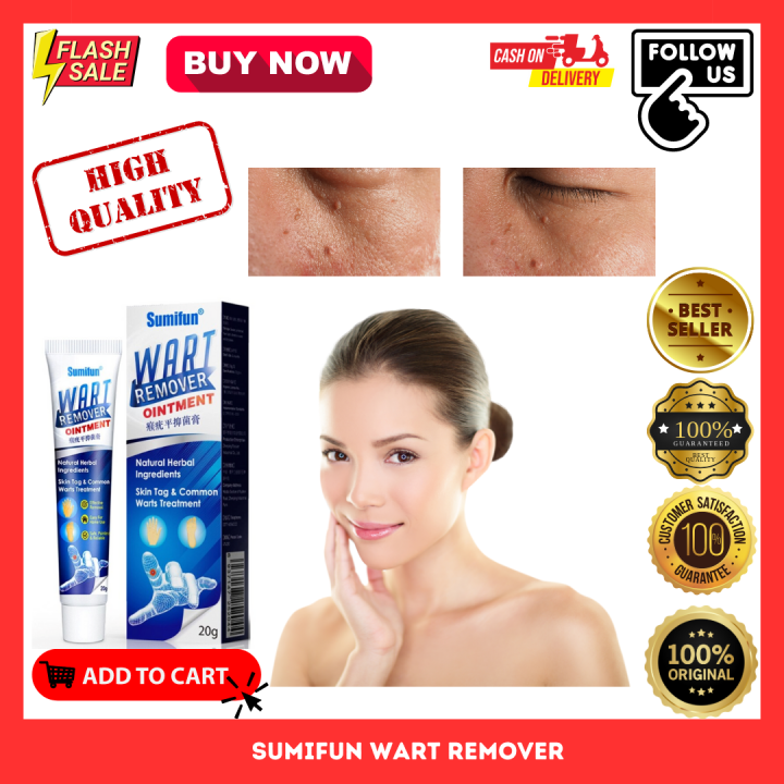 SUMIFUN Warts Remover Original Cream Warts Magic Remover Cream Skin ...