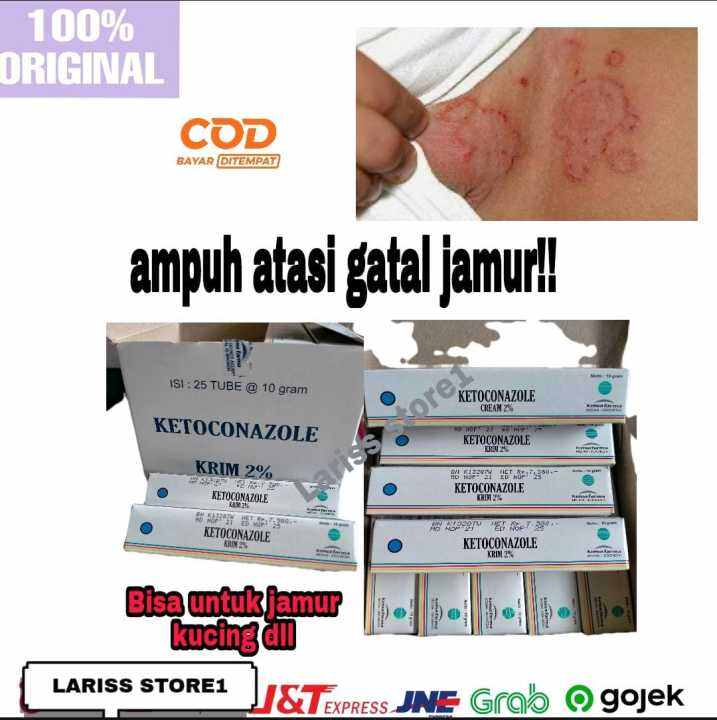COD MURAH ORIGINAL Salep Gatal Ampuh Salep Kulit Gatal Jamur Obat Gatal ...