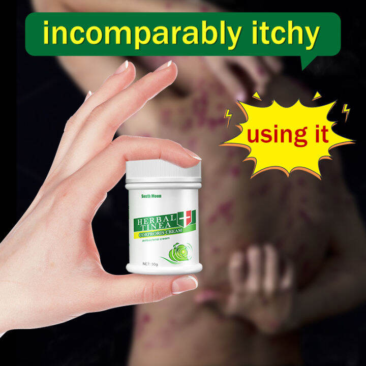 [3pcs] Anti-bacterial Anti-Itch Dry External Stubborn Skin Amazing ...