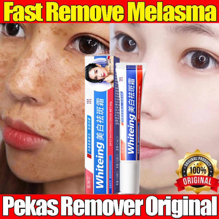 Effective Japanese Melasma Cream Original 20g freckle removal Whitening ...